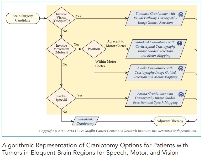 Brain Surgery Options - Neurosurgery - Dr. Etame